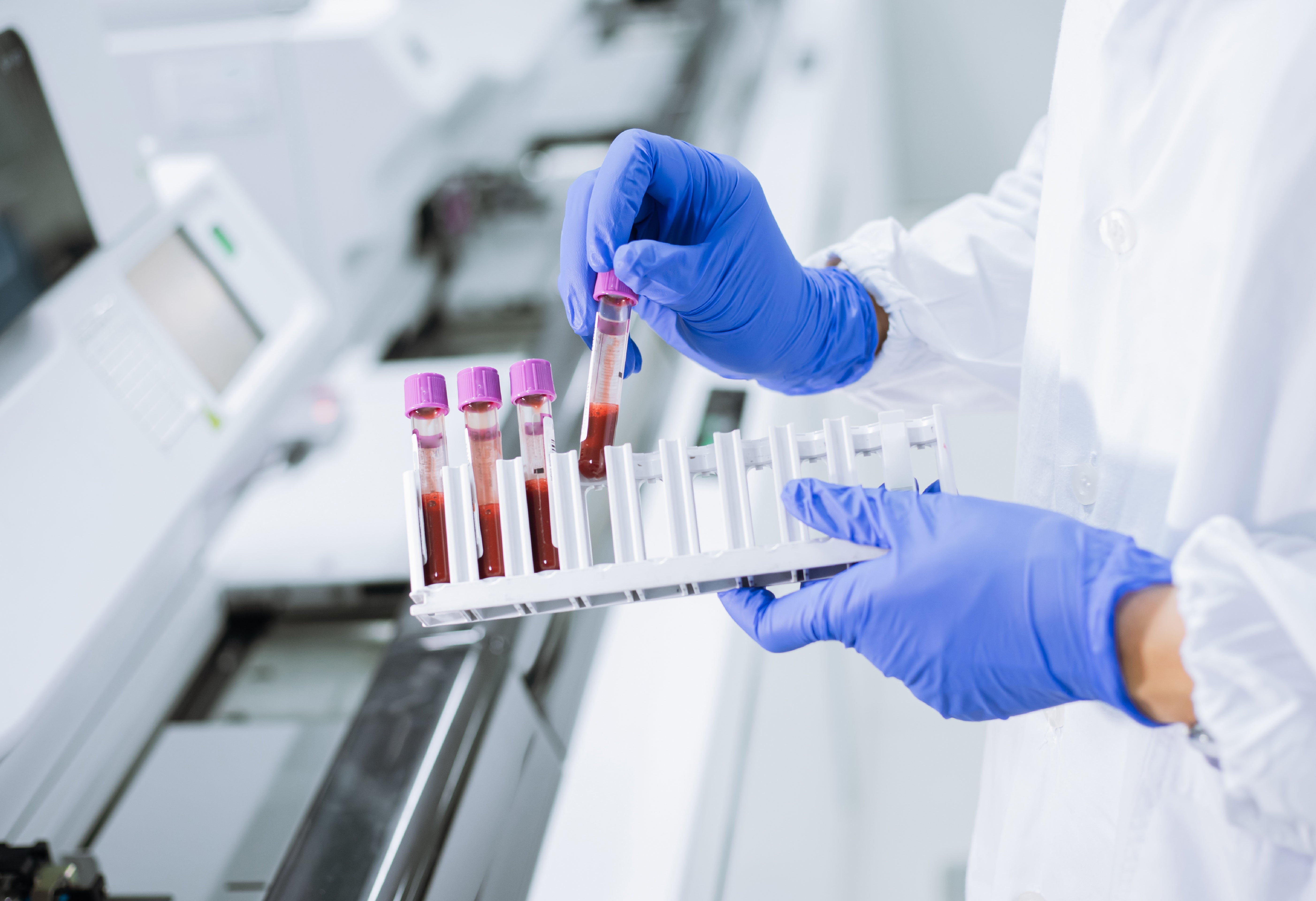 Perfil de lípidos en CAP Valle Poniente – TecSalud Store